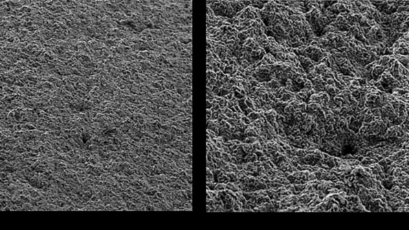 Cylinder Bore Surface Treatment, Under Pressure | American Machinist